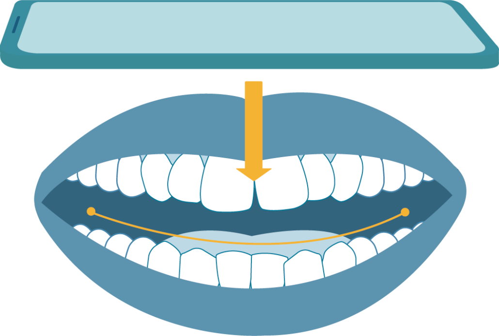 Text us your teeth | Orthodontic consultations by text
